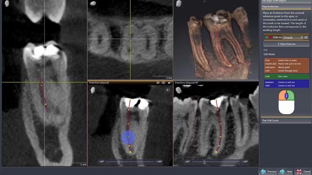 Ứng dụng của CBCT trong nha khoa | Bệnh Viện Răng Hàm Mặt TPHCM